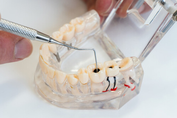 Can A Tooth Abscess Make You Sick? | Total Care Dental Studio