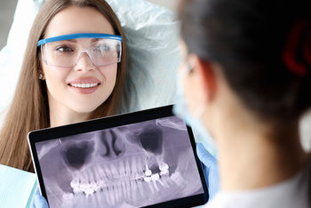 Steps Of Teeth Prepped For Veneers: A Practical Guide