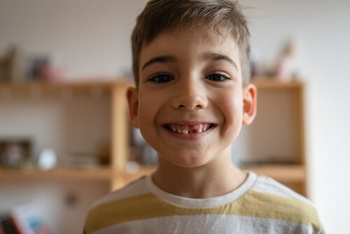Tooth Extraction White Stuff Fell Out No Pain : Why And How?